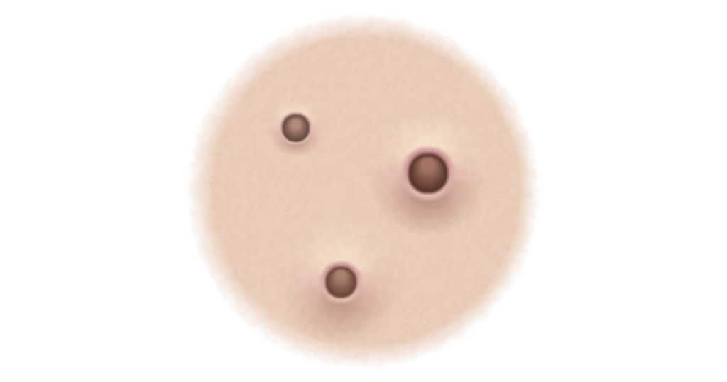 Common Skin Conditions - Southern Dermatology